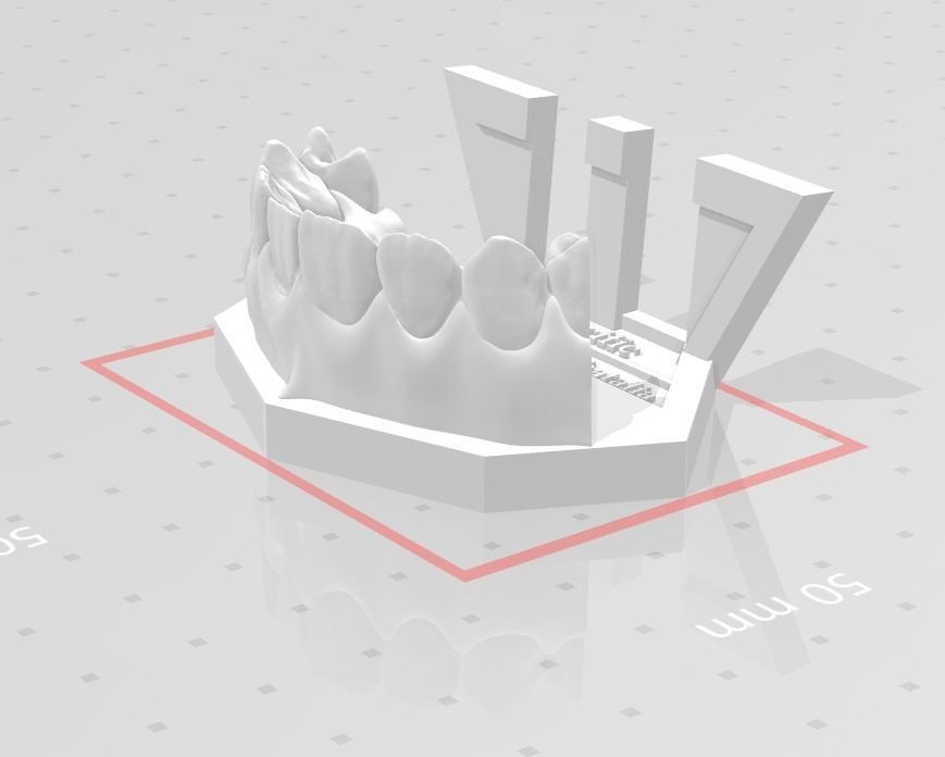 Segmented Anterior Direct Veneer by EDM DENTAL PRACTICE 3D model 3D ...