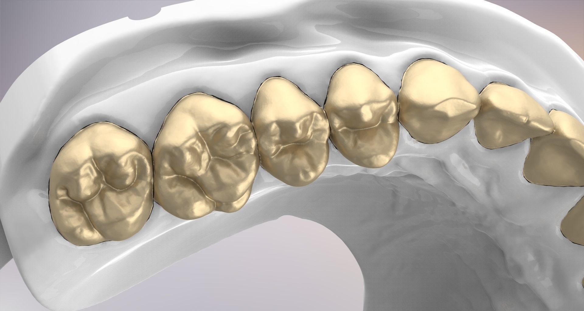 3D Dental Jaws Replica with Detachable Teeth 3D model 3D printable ...