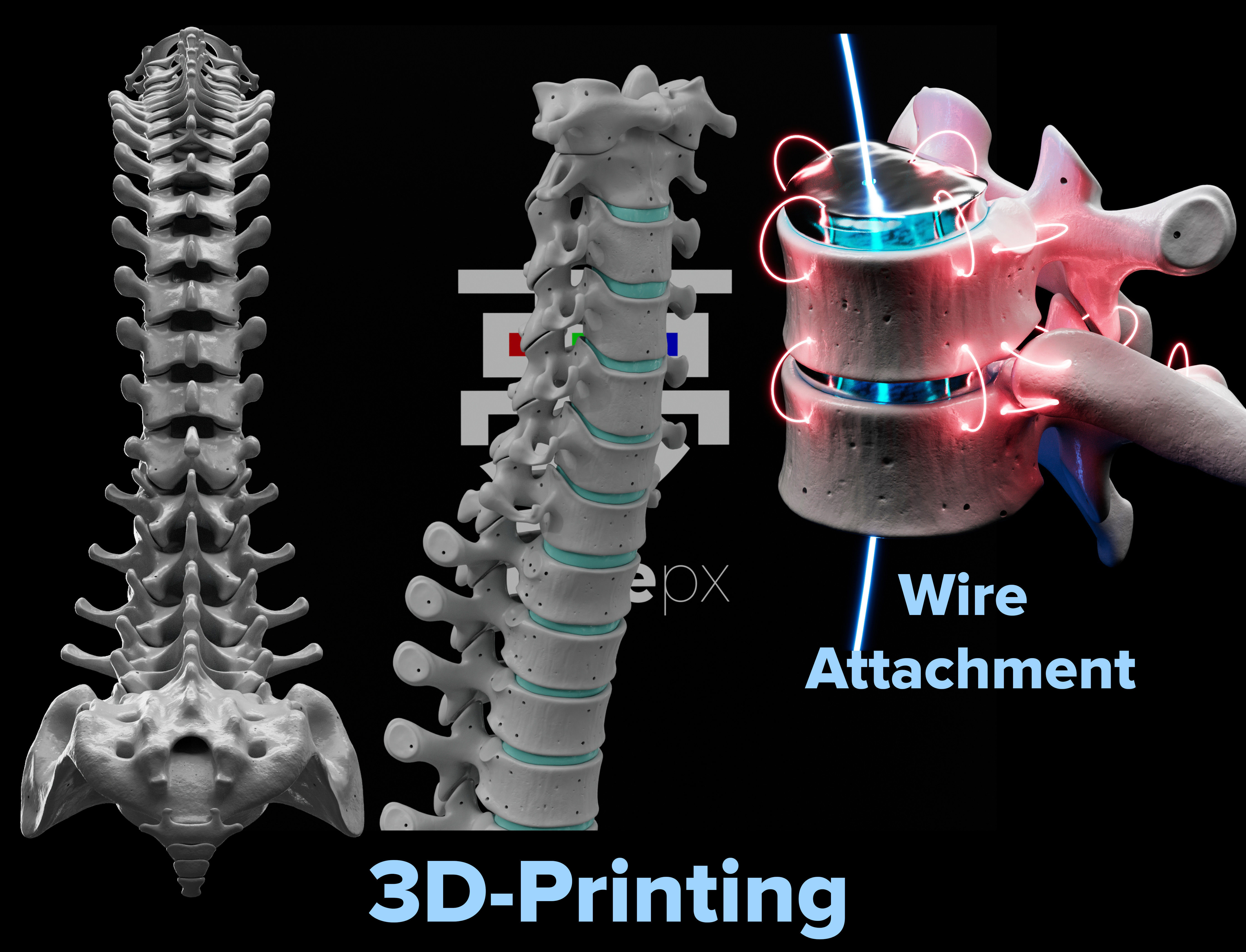 Human Spine - Vertebral Column 3D model 3D printable | CGTrader