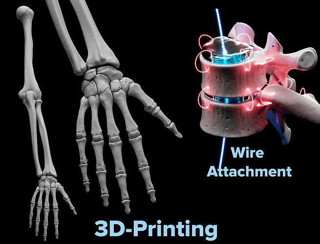 Human Rt Arm and Hand bones 3D model 3D printable | CGTrader