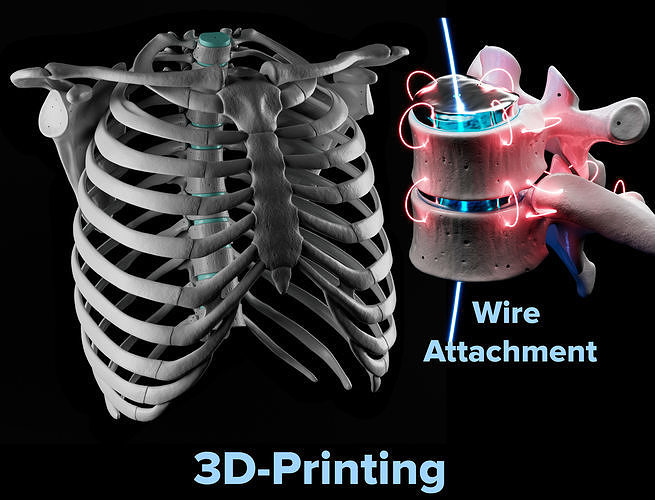 Rib Cage - TSpine - Scapula - Clavicle 3D model 3D printable | CGTrader