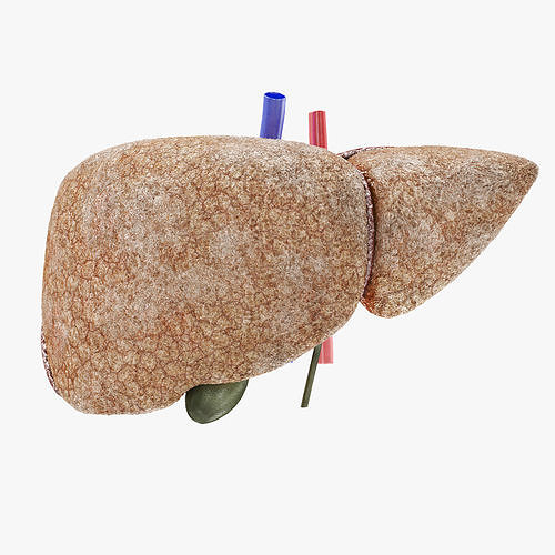 Fibrosis Liver 3D model | CGTrader